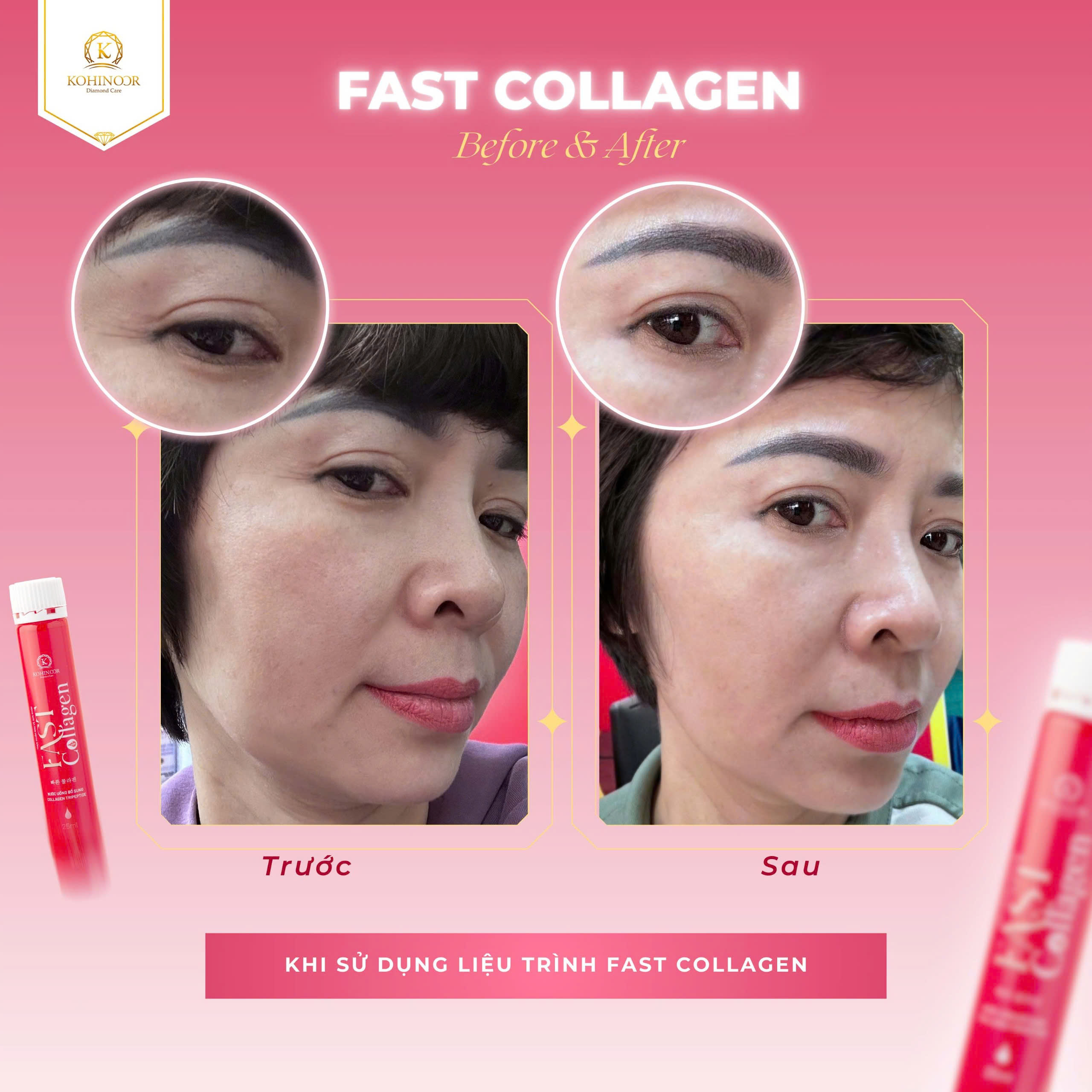 Fast Collagen – Sản phẩm chính hãng của Tập Đoàn Kohinoor Star